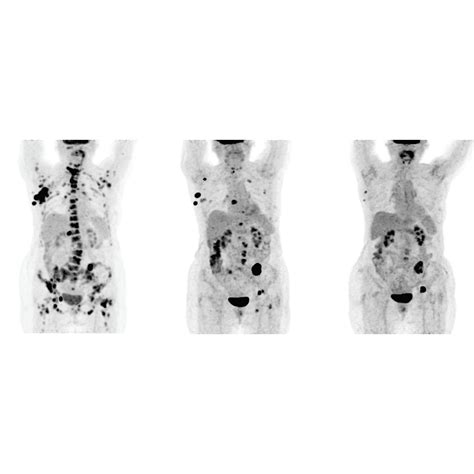 Mediso Interview™ Fusion Processing Software