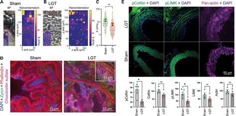 Neointima Formation Is Accompanied By Reduced Extracellular Matrix Download Scientific Diagram