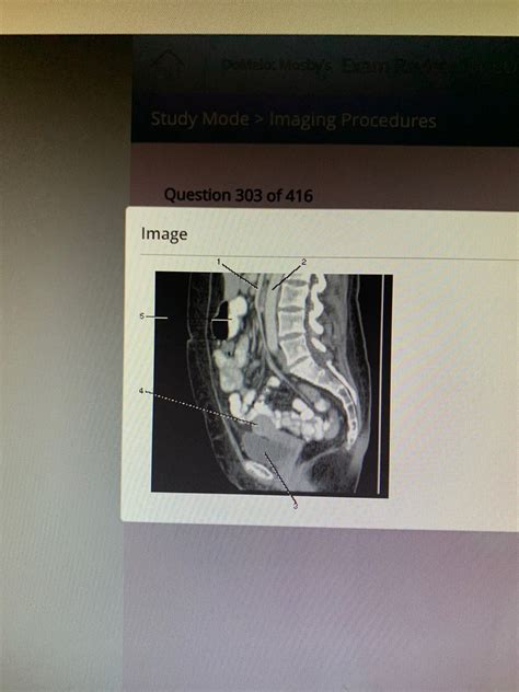 Ct Sagittal Pelvis Diagram Quizlet