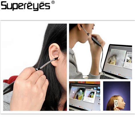 Online Buy Wholesale Ear Microscope From China Ear Microscope Wholesalers