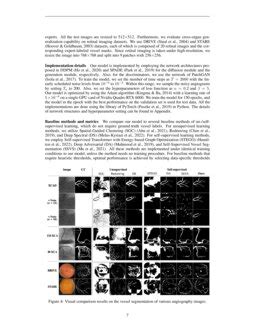 Diffusion Adversarial Representation Learning For Self Supervised