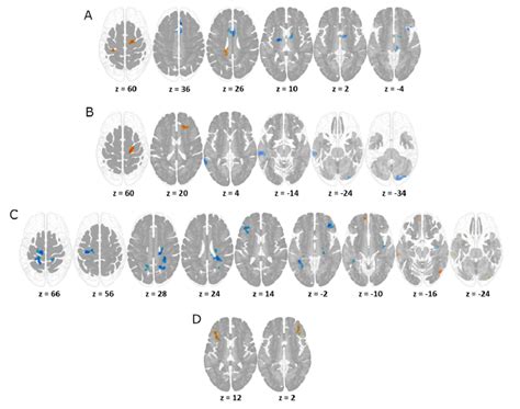 Regions Showing Significant Spearman Partial Correlation Between Download Scientific Diagram