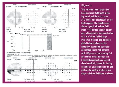 quality of life metrics improve glaucoma staging