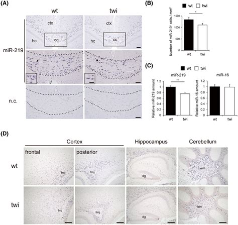 Reduced Expression Of Mir‐219 In Developing Twitcher Mouse Brain A
