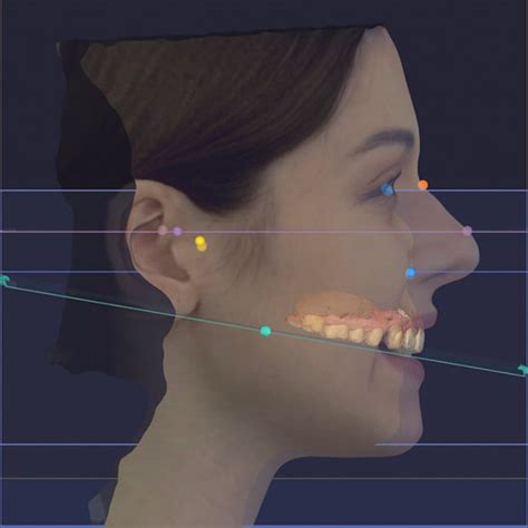 Rayface Review Is It The Best 3d Facial Scanner For Dentists