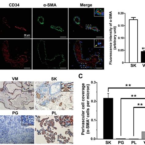 Vmecs Exhibited Cobblestone Morphology Under Phase Contrast Microscope