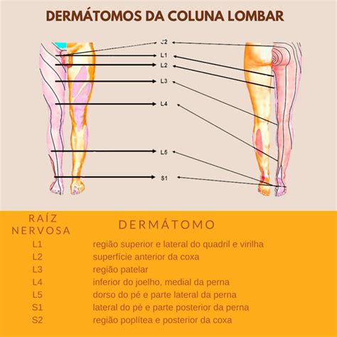Síndrome Da Cauda Equina Saiba Tudo Sobre Esta Patologia