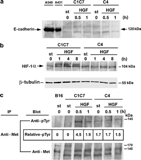 Protein Expression Of E Cadherins And Hif 1 And Met Protein Level And