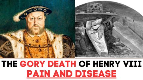 The Gory Death Of King Henry Viii Pain And Disease Youtube