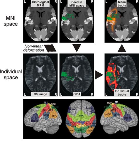 Figure 1 From Anatomical And Functional Connectivity Of