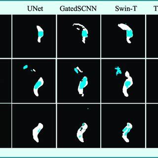 Visual Comparison Of Segmentation Results Of Different Methods In The