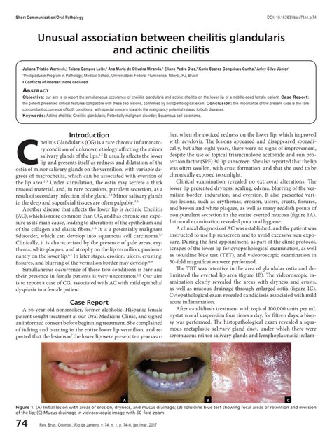 Pdf Unusual Association Between Cheilitis Glandularis And Actinic