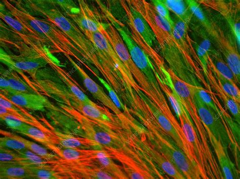 Skeletal Muscle Cells Light Micrograph Stock Image C0253218