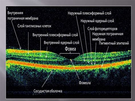 Оптическая когерентная томография презентация онлайн