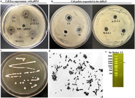 Isolation Identification And Antibacterial Characteristics Of Lacticaseibacillus Rhamnosus Yt