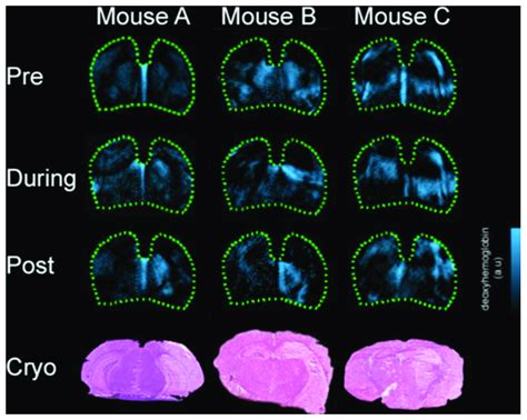 Deoxy Hemoglobin Distributions Which Were Estimated Using Download Scientific Diagram