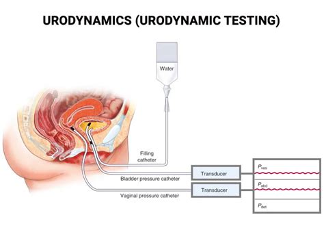 Urodynamics Urodynamic Testing Best Gynecologists In Nyc Brooklyn