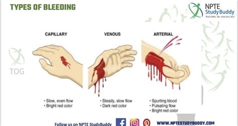 Capillary Bleeding Is Characterized By Mapasgmaes