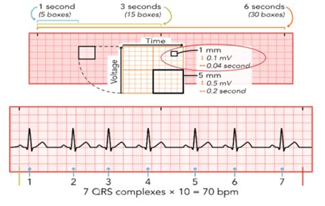Cardiac Rhythms Flashcards Quizlet