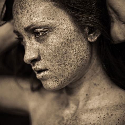 Lots Of Freckles