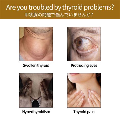 Japan Thyroid Gland Treatment Cream For Thyroid Nodule Protruding Eyes