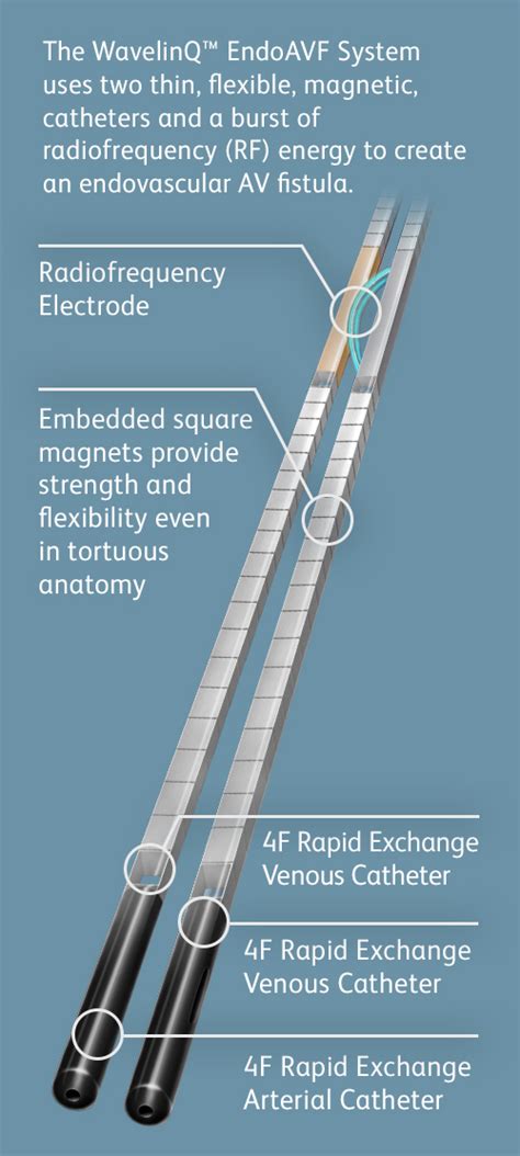 Our Product Wavelinq™ Endoavf System Specification Wavelinq