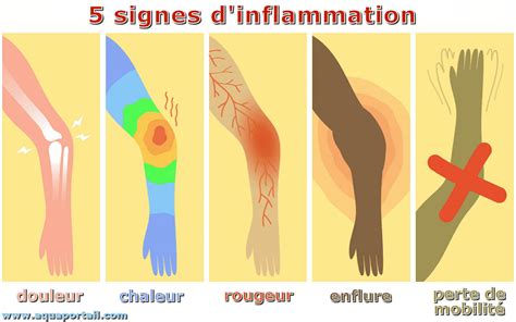 Inflammation définition et explications