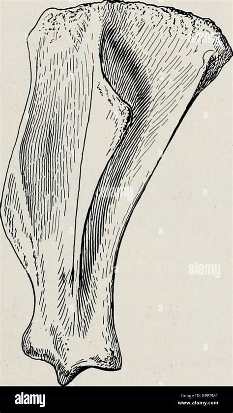 Scapular Notch
