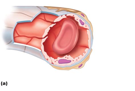 Continuous Capillaries