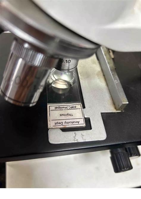 Summary Histology Of Lymphoid Tissue Usmle Stuvia Us