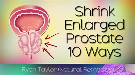 Enlarged Prostate