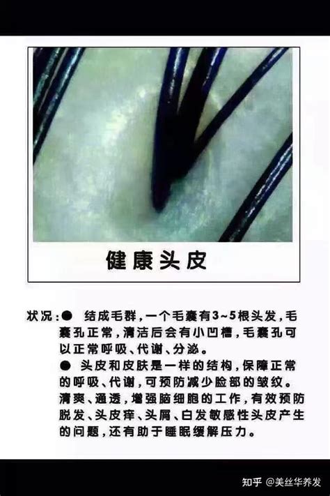 染发的危害 知乎