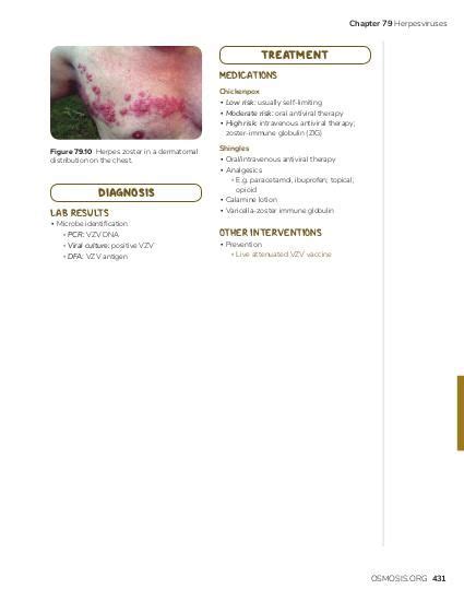 Herpes Simplex Virus Osmosis