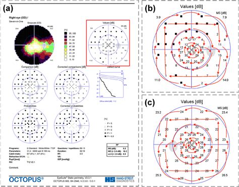 The Visual Field Vf Report And The Extraction Order Of The Values