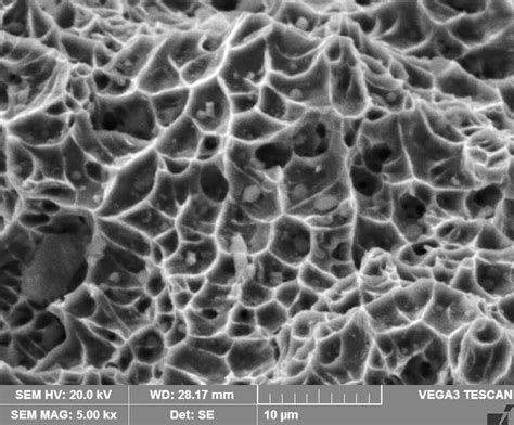 Fractures In The Sem Vgo Inc