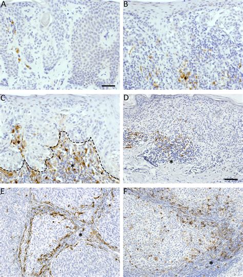 Representative Immunohistochemical Stainings Of Ido Download