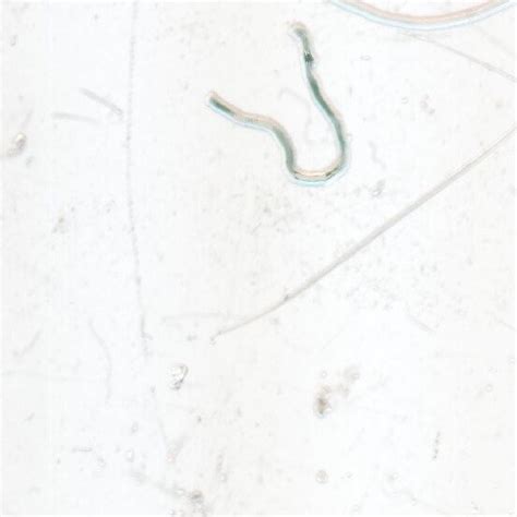 Pdf Automatic Counting And Classification Of Microplastic Particles