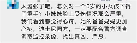 女童被恶意推倒受伤，迪士尼回应澎湃号·媒体澎湃新闻 The Paper