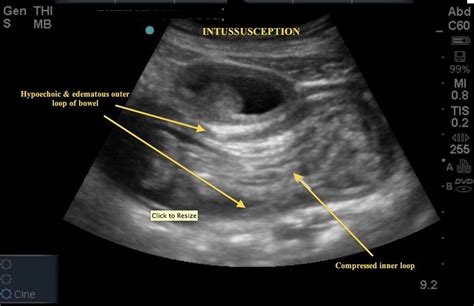Pin On Usmle Step 2