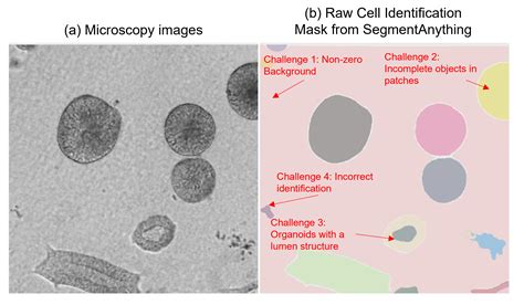 Github Xiaodanxing Sam Organoid The Github Repository For Our Paper Segmentanything Helps