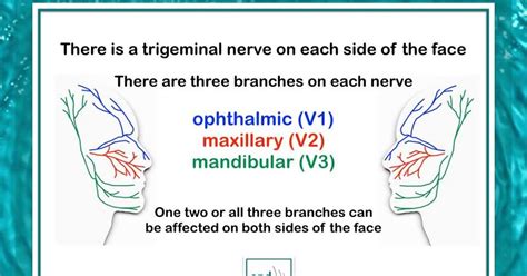 End Trigeminal Neuralgia What Is Trigeminal Neuralgia