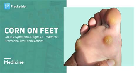 Corn On Feet Causes Symptoms Diagnosis Treatment