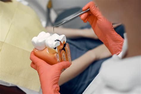 ¿qué Es Una Endodoncia Y Cómo Se Dice En Inglés