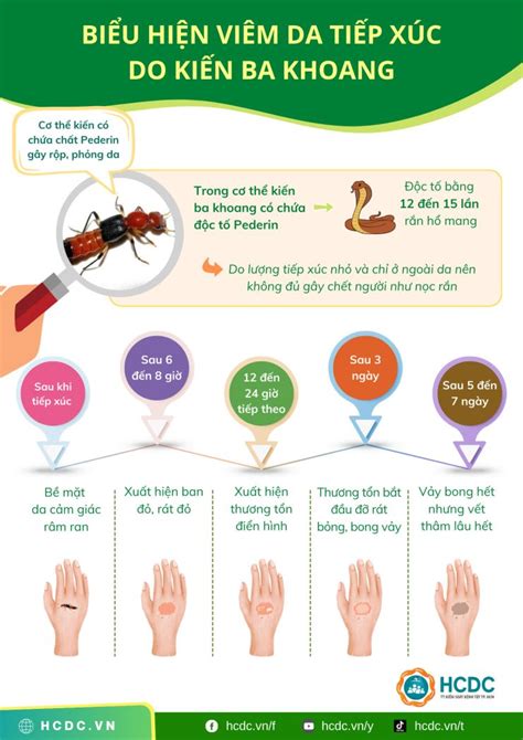 Hcdc Bi U Hi N Vi M Da Ti P X C Do Ki N Ba Khoang B Nh Vi N A Khoa L Nh Binh Th Ng