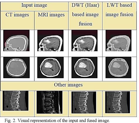 Figure 2 From Establishment Of An Effective Brain Tumor Classification