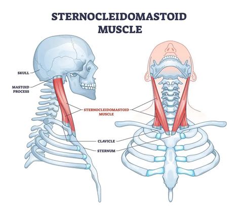 Sternocleidomastoid Trigger Points Causes Symptoms And Treatment Trigger Point Secrets