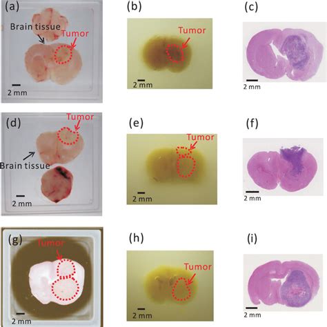 Refractive Index Spectra Of Fixed And Paraffin Embedded Tissues In The Download Scientific