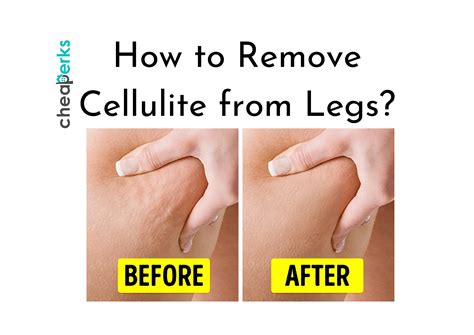 How To Remove Cellulite From Legs Easy And Instant Methods Added
