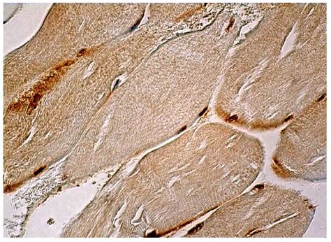 Anti Pdgf B Antibody F 3 Scbt Santa Cruz Biotechnology