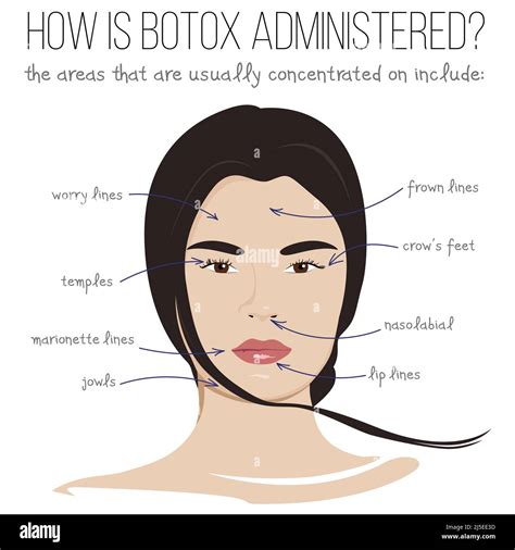 Botulinum Toxin Injection Stock Vector Images Alamy